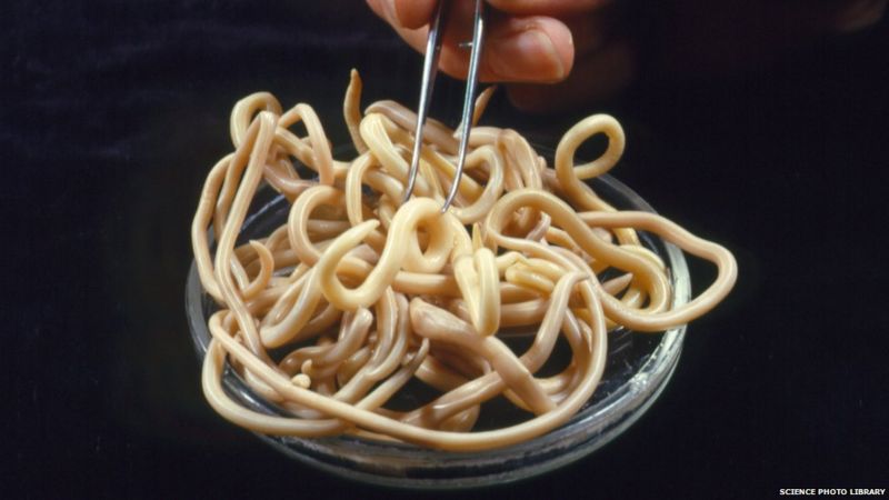 Is it worth treating everyone who might get worms? - BBC News