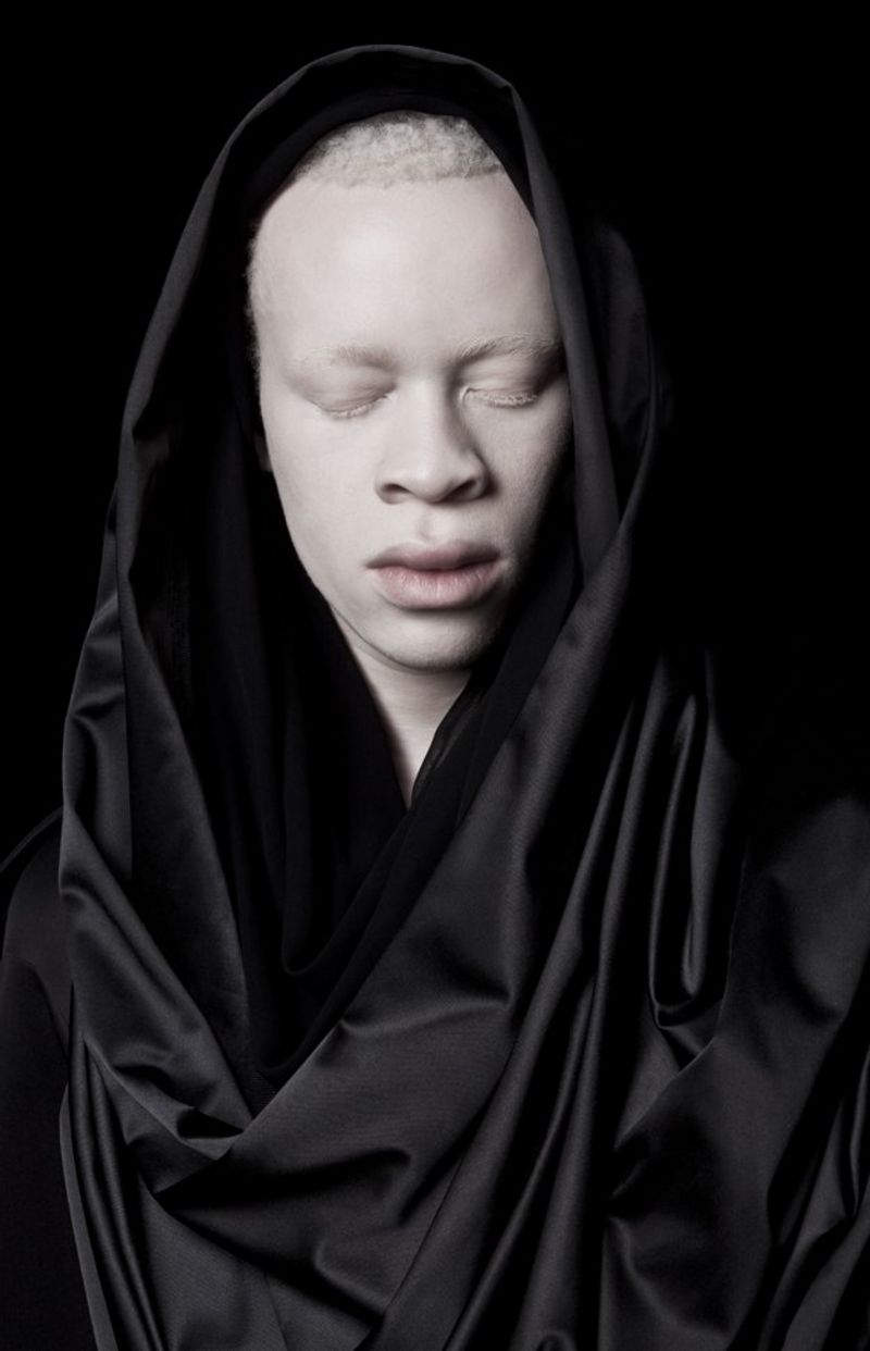 In pictures: Albinism and perceptions of beauty - BBC News