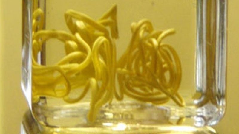 President Carter vs Guinea Worm - BBC News