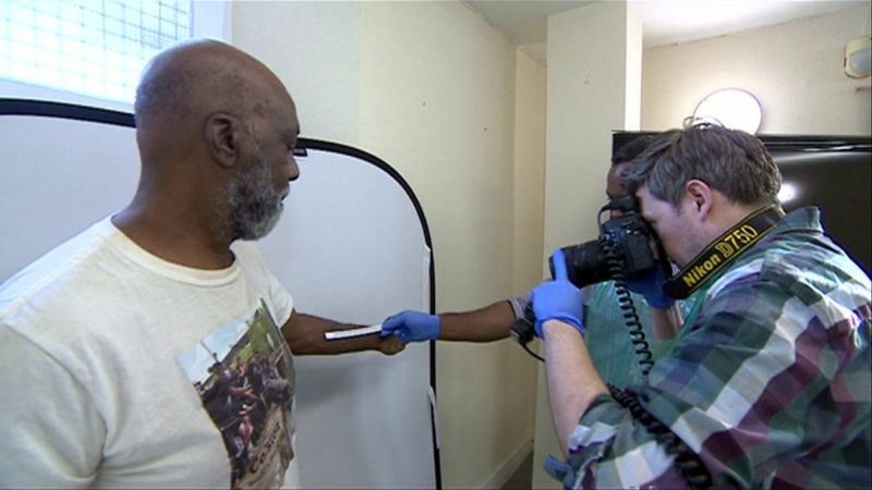 NHS project tackles diversity of skin tones in medical photos - BBC ...