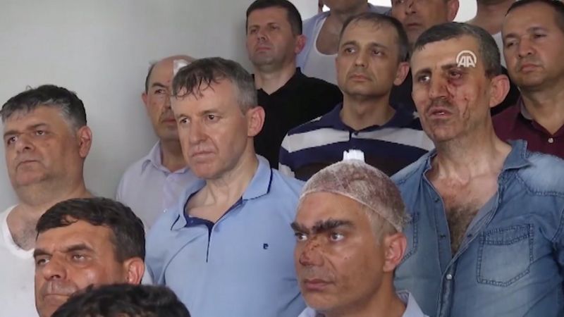 Turkey torture claims in wake of failed coup - BBC News