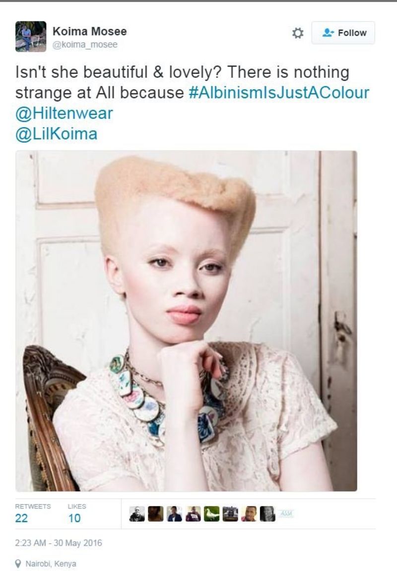 Challenging Africa's albino stereotypes - BBC News