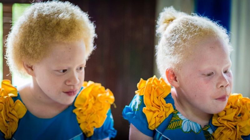 Film highlights Fiji's baffling rate of albinism - BBC News