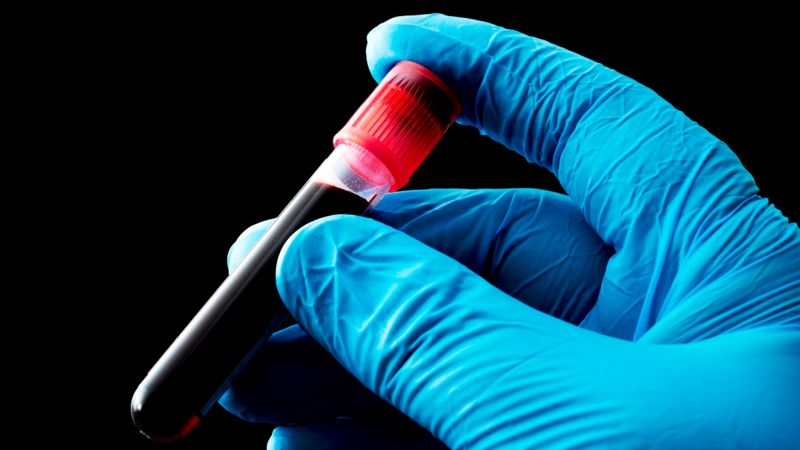 Galleri cancer test: What is it and who can get it? - BBC News