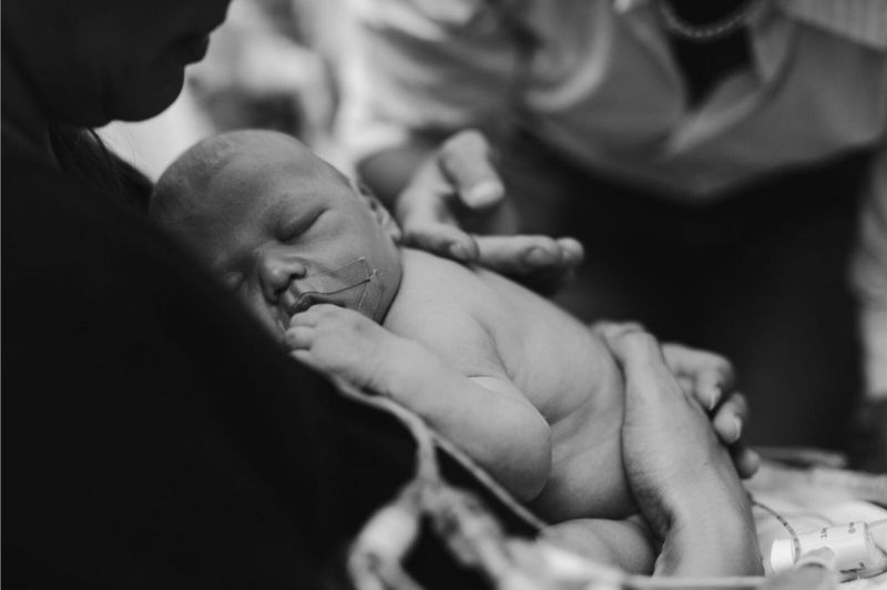 Baby Edison's short life shines light on rare disorder - BBC News