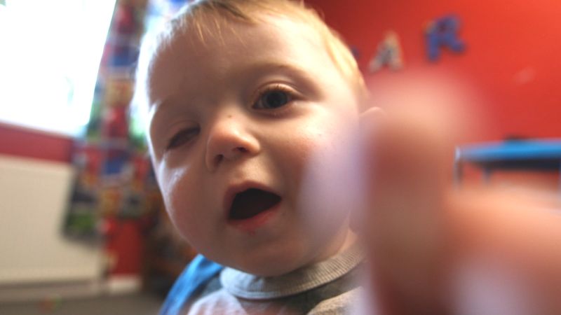 Toddler's eyeball sliced in half by drone propeller - BBC News