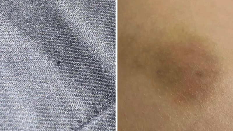 Ipswich: Spiking by needle victim too scared to go out - BBC News