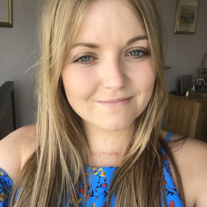 New Year fire survivor Bex Williams says charity saved her life - BBC News