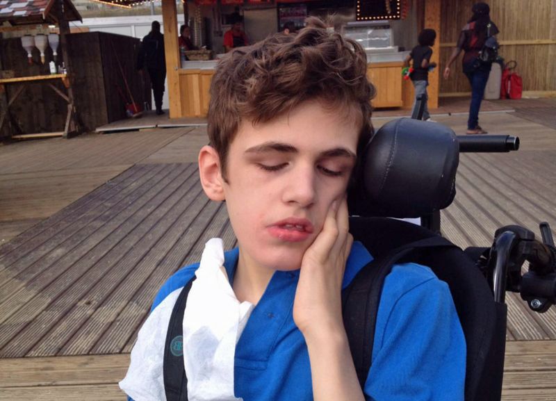 The children living with the world's rarest diseases - BBC News