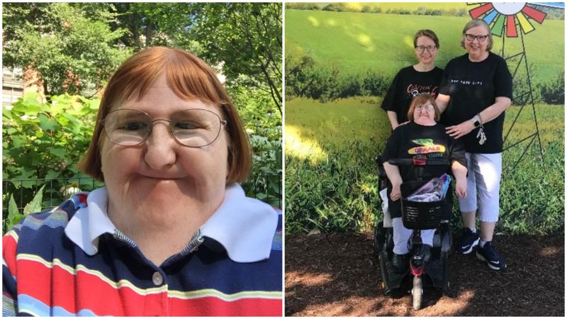 Disability blogger: 'Trolls said I was too ugly for selfies, so I hit ...