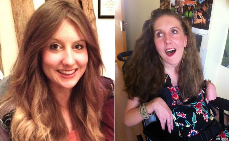 Amy May Shead's family warn 'allergies can cause life-changing damage ...