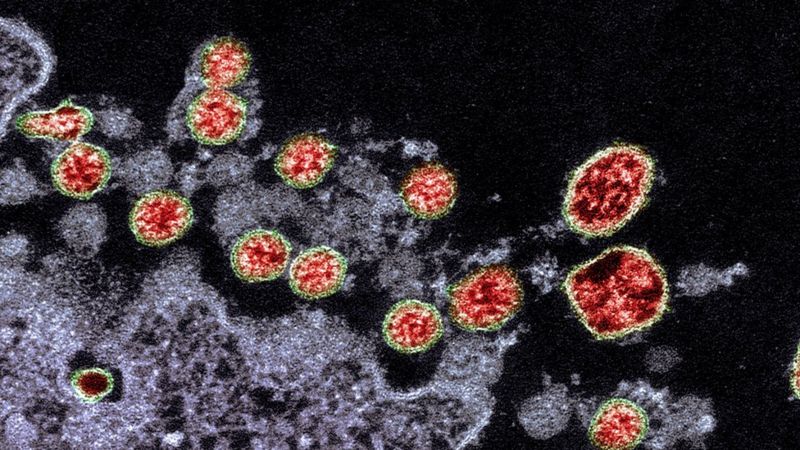 Coronavirus: qué significa exactamente estar curado después de haber ...