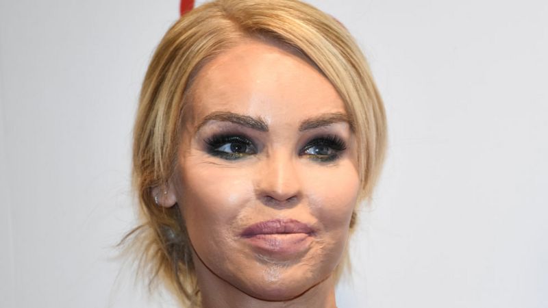 Katie Piper 'trying to deal with' acid attacker release - BBC News