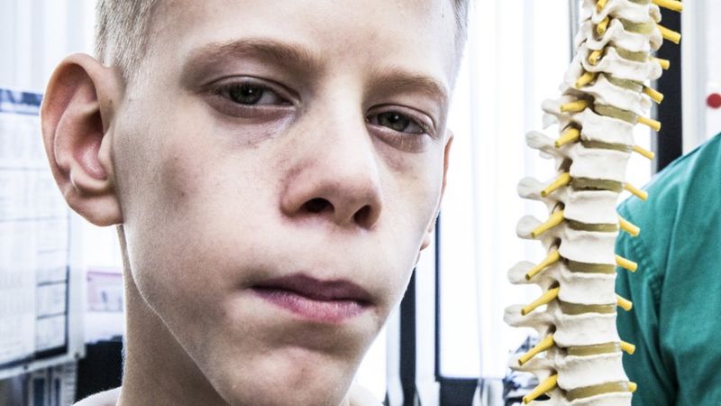 Hospital backlog: The boy who waited 47 weeks for spine surgery - BBC News