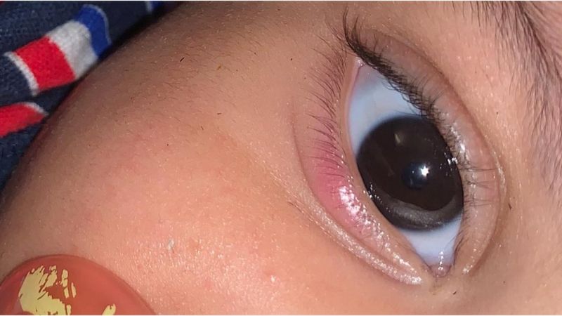 Council tenant: 'Cockroaches bit my baby's face' - BBC News