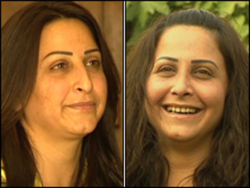 More cosmetic surgery in Iraq after drop in violence - BBC News