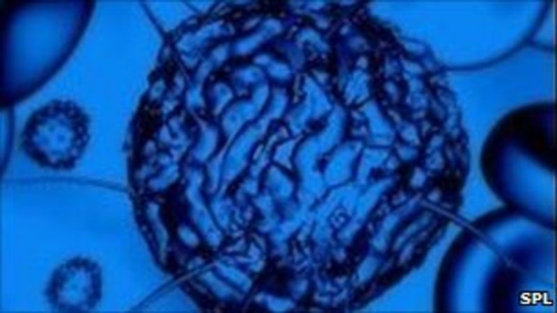 First trial of embryonic stem cells in humans - BBC News