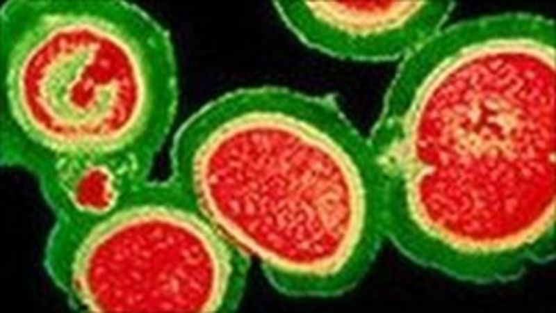 MRSA superbug death total 'continues to fall' - BBC News