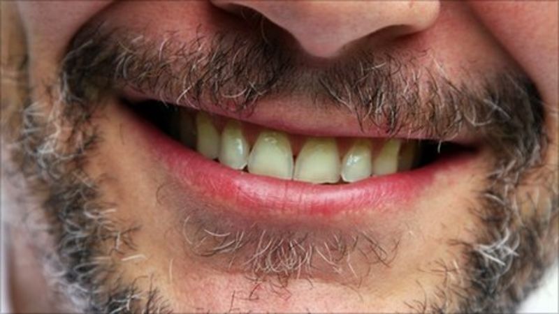 How dangerous is teeth whitening? - BBC News