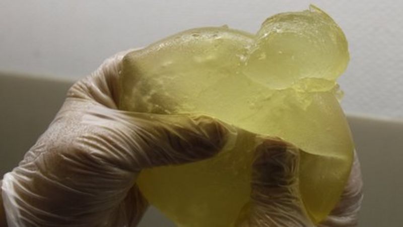 PIP breast implants: 'serious lessons must be learned' - BBC News