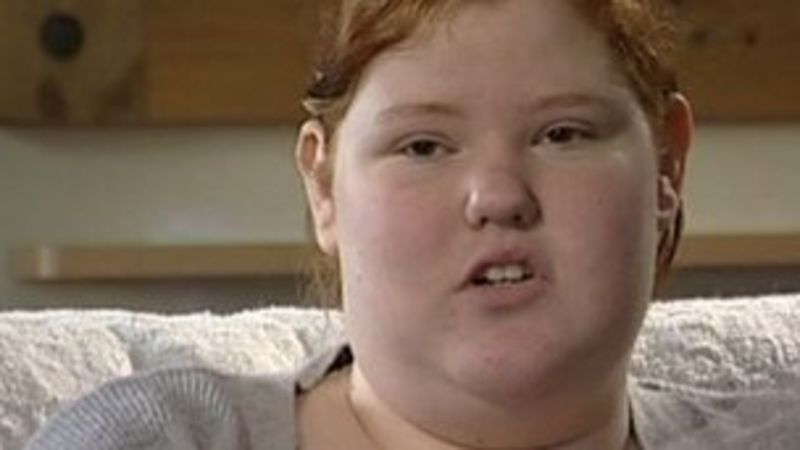 UK obesity: Is diet or surgery the best cure? - BBC News