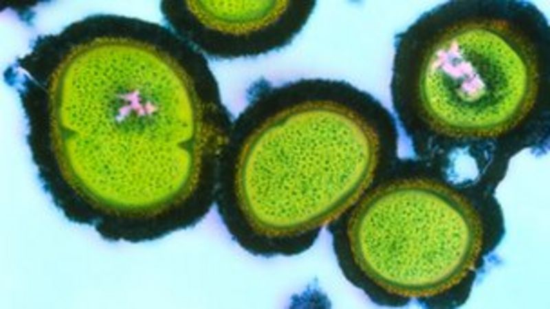 New MRSA bacteria test developed by Edinburgh University scientists ...