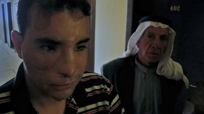 Fixing bodies broken in years of Arab world violence - BBC News