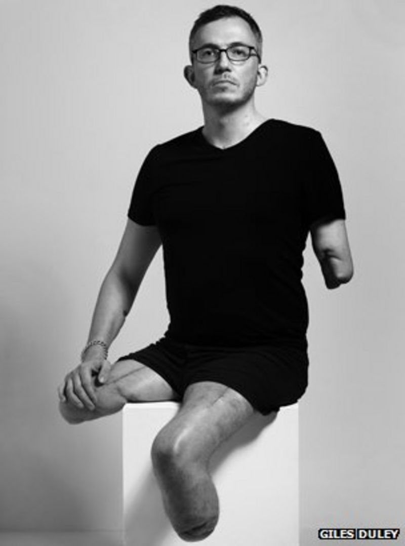 Giles Duley - a second shot at life - BBC News