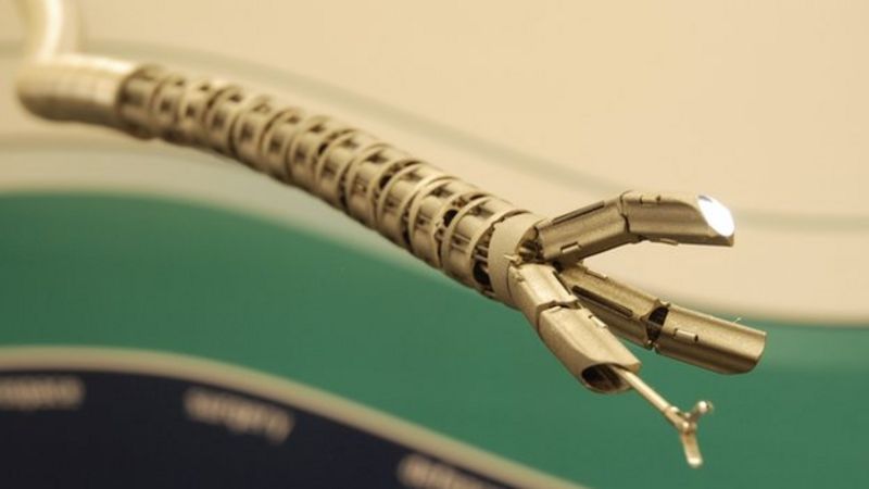Robotic tentacle targets keyhole surgery - BBC News