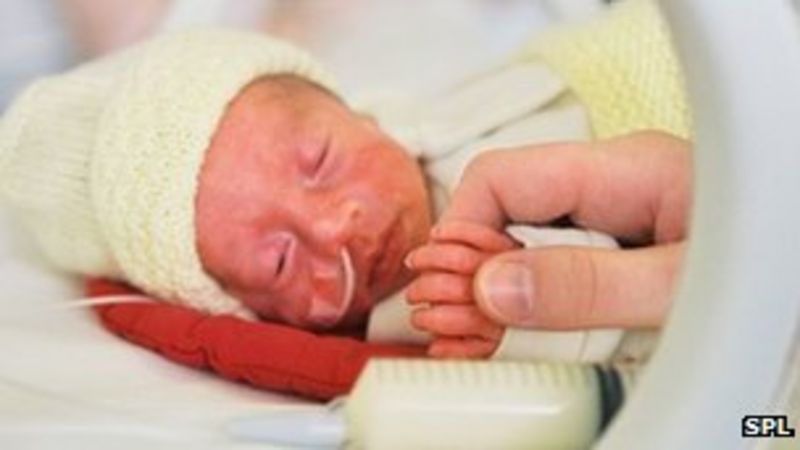 'Too little known' on early birth - BBC News