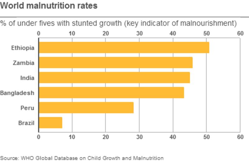 Viewpoint: Let's make malnutrition visible - BBC News