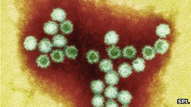 Cases of the winter vomiting bug 'top a million' - BBC News