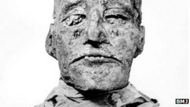 King Ramesses III's throat was slit, analysis reveals - BBC News