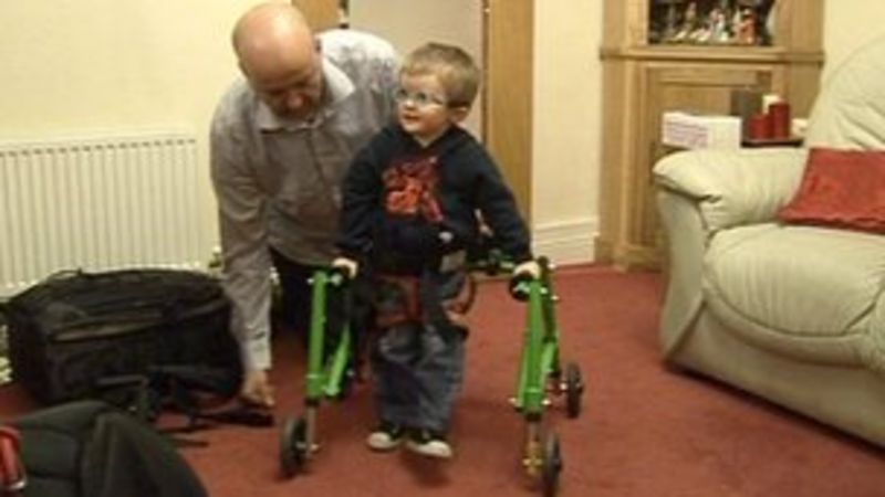 1P36 Deletion Syndrome: Could there be a rare Celtic genetic link to ...