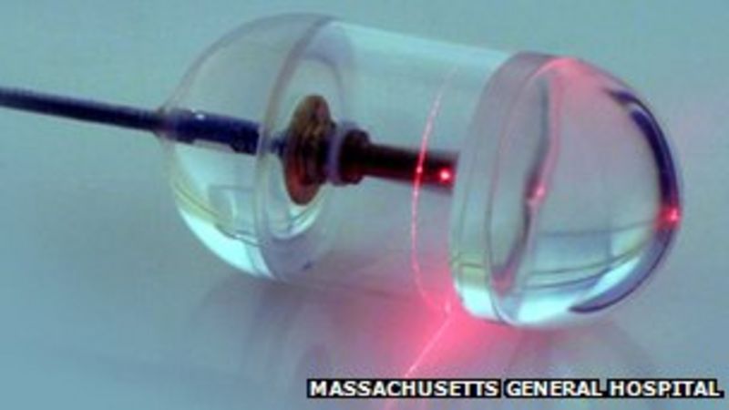 Pill-sized scanner images gullet - BBC News