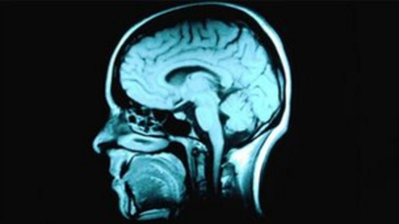 Brazil health authorities investigate MRI scan deaths - BBC News