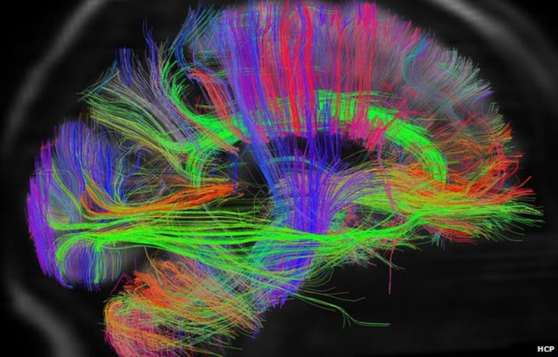 Scans reveal intricate brain wiring - BBC News