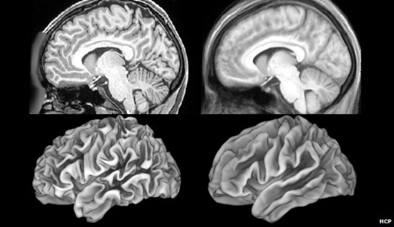 World's most detailed scans will reveal how brain works - BBC News