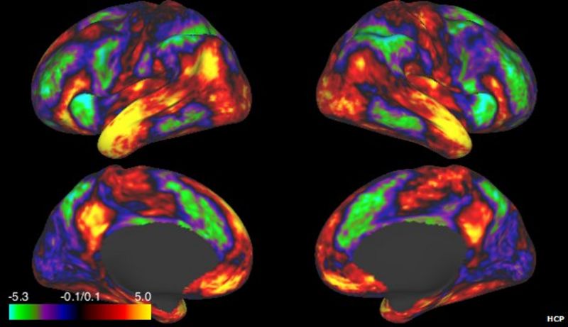 World's most detailed scans will reveal how brain works - BBC News