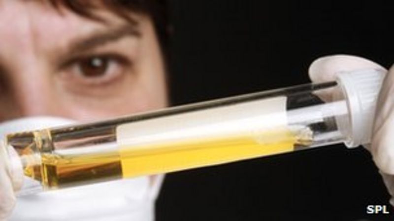 Urine odour test for bladder cancer - BBC News
