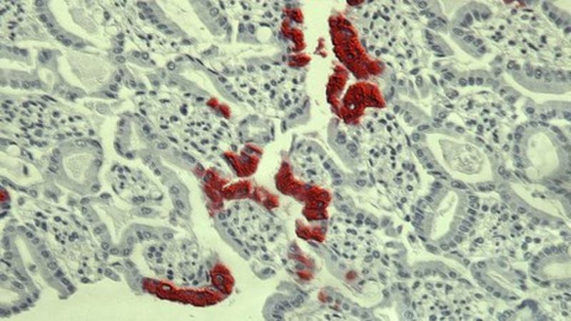 Clue to why cat virus turns deadly - BBC News