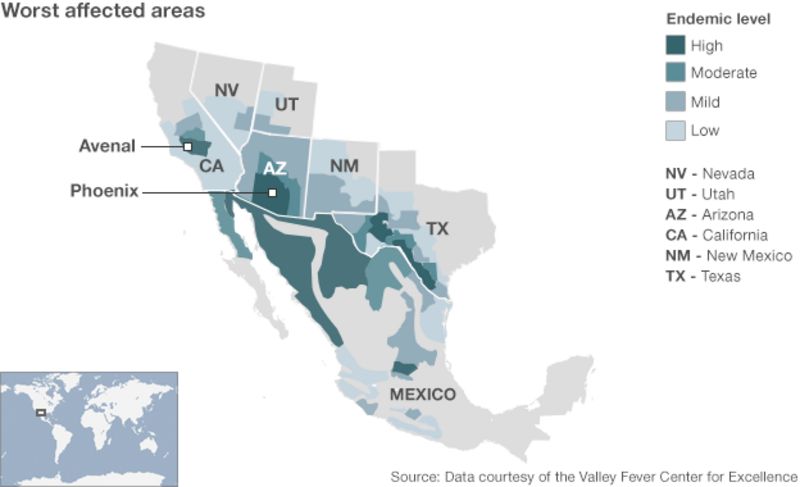 Valley fever: An incurable illness in the dust - BBC News