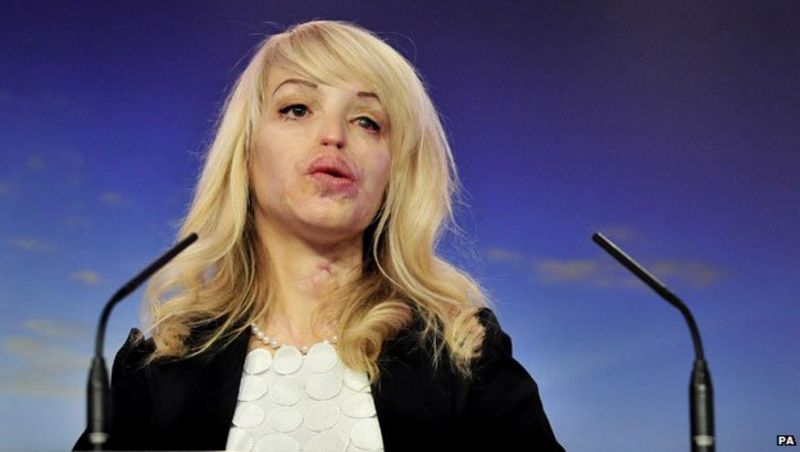 How many acid attacks are there? - BBC News