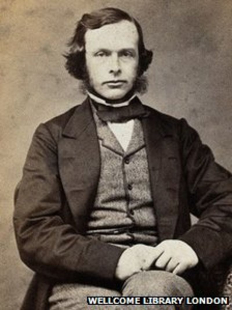 Joseph Lister's unknown operation uncovered - BBC News