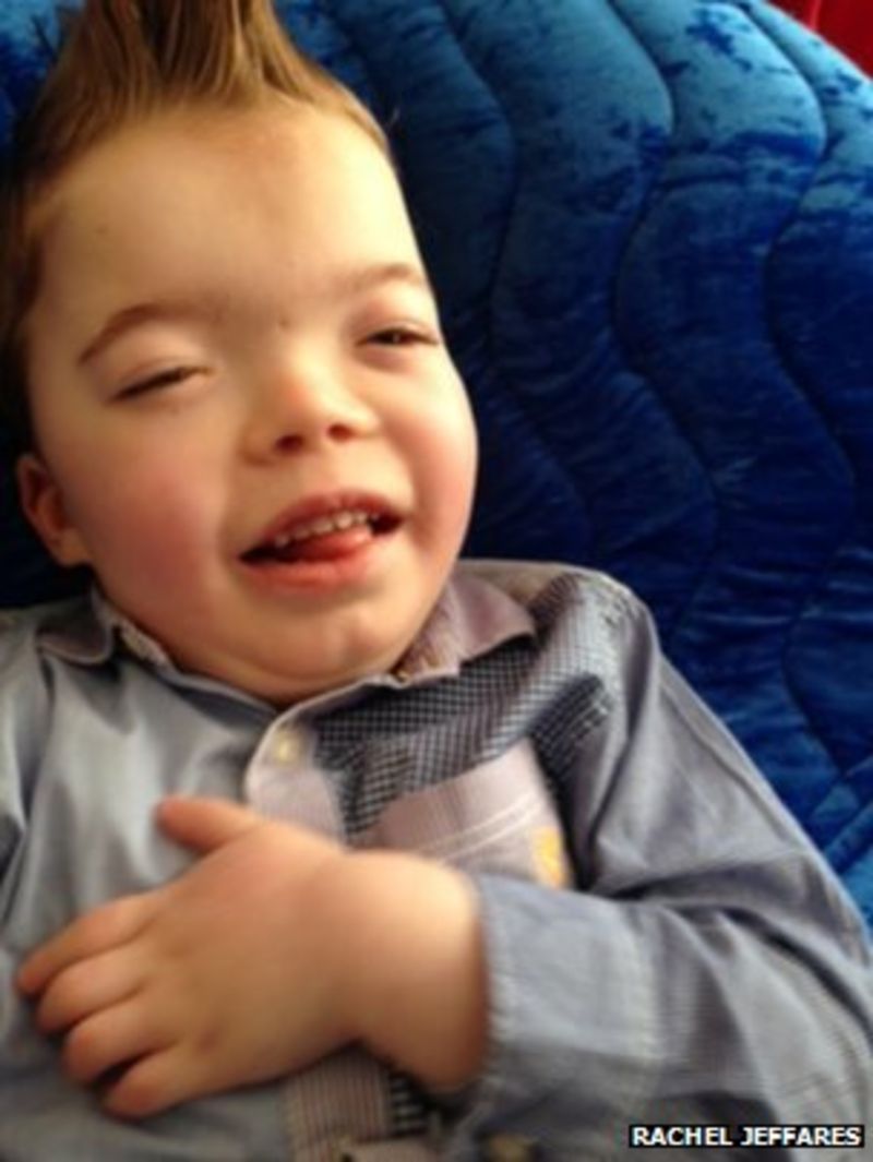 Technology is helping to give genetic disorders a name - BBC News