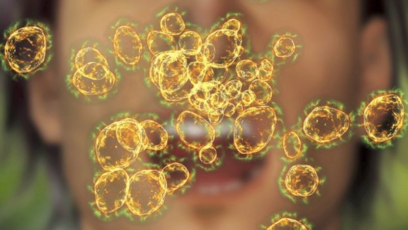 Bird flu: New EU measures after Dutch and UK cases - BBC News