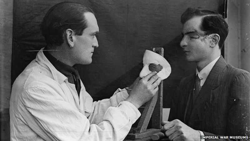 World War One: Soldiers helped at Wandsworth 'Tin Noses Shop' - BBC News