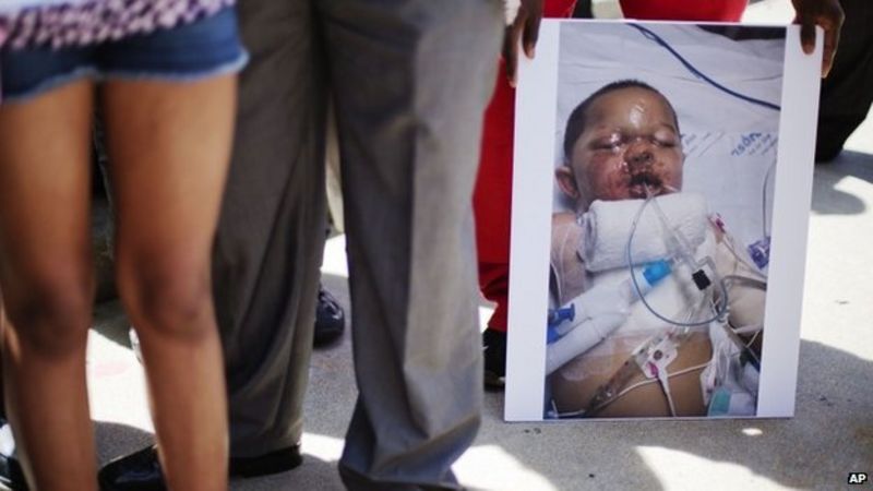 Mother blasts police for burned baby - BBC News