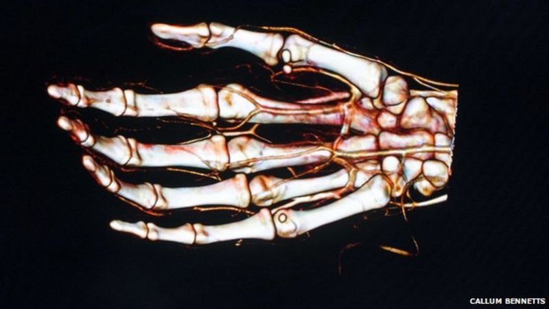 Anatomy students work on life-size virtual cadaver at University of ...