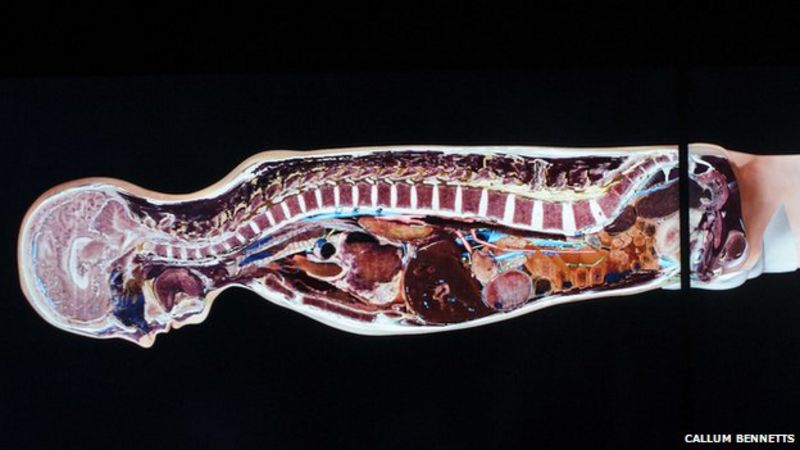 Anatomy students work on life-size virtual cadaver at University of ...